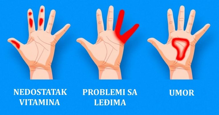 10 najvažnijih stvari koje ruke otkrivaju o vašem zdravlju | Lijek iz ...